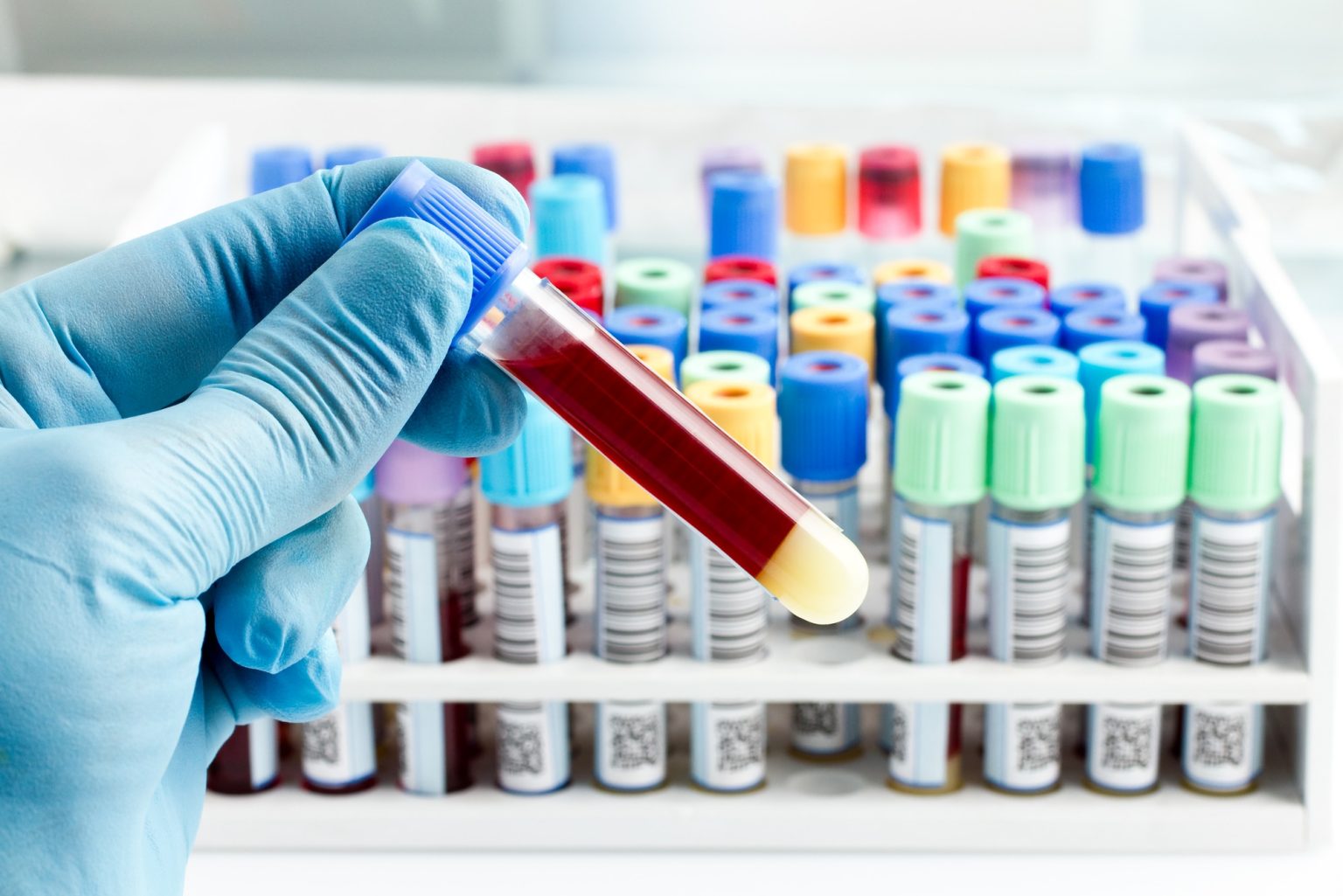 Laboratory | Coastal Family Health Center